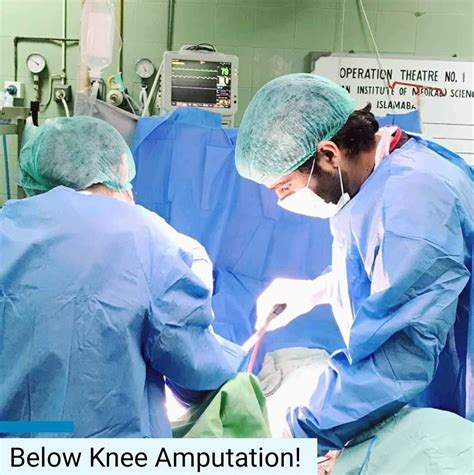 Dr Mohsin Ali On Linkedin Diabetic Knee Amputation Patient Exercise Stayfit