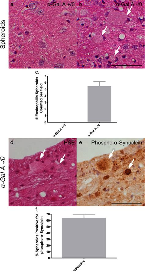 Phosphorylated α Synuclein Aggregates Localized To Axonal Spheroids Download Scientific Diagram