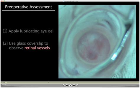 Video Of Subretinal Injection By Transcorneal Route This Video Was Download Scientific Diagram