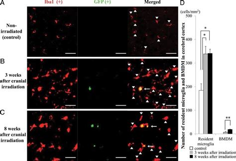 Migration Of BMDM In The Cerebral Cortex After The Cranial Irradiation Download Scientific