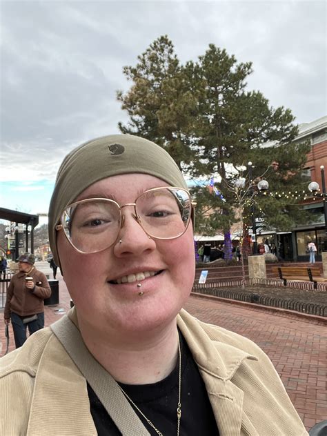 Bald Psoriasis Journey Part 3 Mossyfawnron