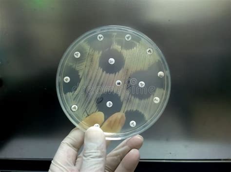 Antimicrobial Susceptibility Testing In Culture Plate Drug Sensitivity Test Antibiotic