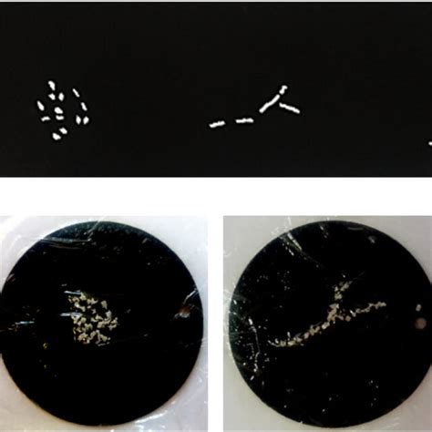 Above Models Of Clusters Of Calcifications Associated To Malignant