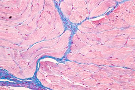 지방 조직 인간 연한 구개 인간 뼈 인간 및 줄무늬 근육 인간을 현미경으로 관찰합니다 골화에 대한 스톡 사진 및 기타 이미지 Istock