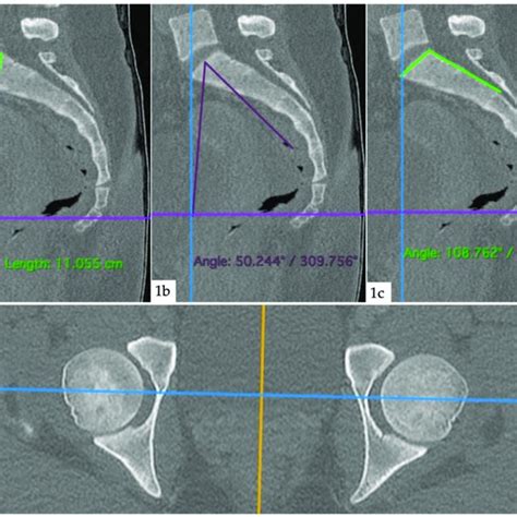 Anatomical Measurements 1a Pelvic Radius Distance Between Download Scientific Diagram
