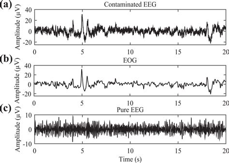 Separation Of Eog Artifact From Real Recorded Eeg Signal Using