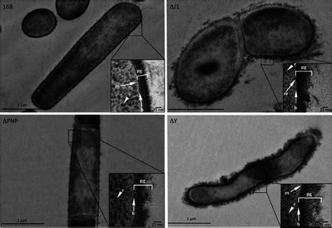 Rnase Y And Rnase J1 Mutants Have Altered Cell Walls Shown Are