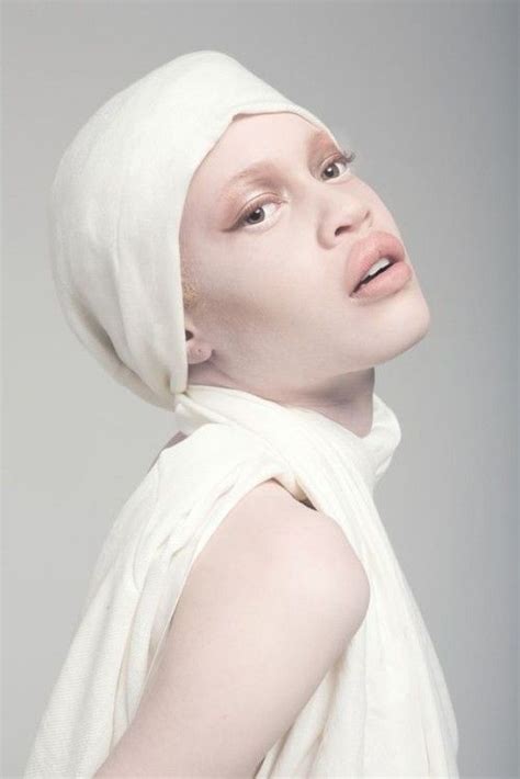 Albino Models Ilbonito Blog 2007 Albino Skin Palette Albino Female