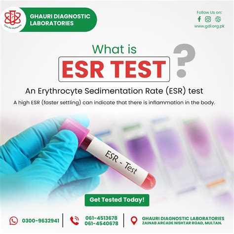 Ghauri 🧪 What Is An Esr Test The Esr Erythrocyte Sedimentation Rate Test Helps Detect