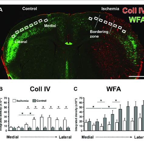Comparative Semi Quantitative Analyses Addressing Immunoreactivity