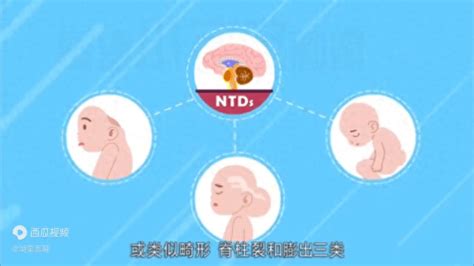 准爸准妈们看过来，关于先天性神经系统畸形防治！这些事要了解叶酸缺陷风险