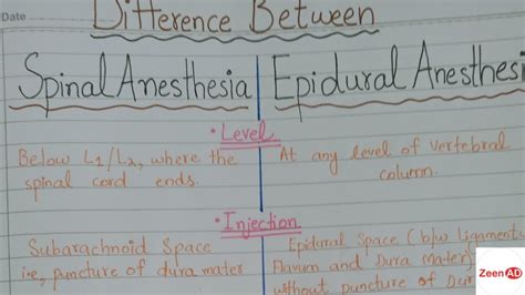 Spinal Block Vs Epidural Nursing At Quentin Sanchez Blog