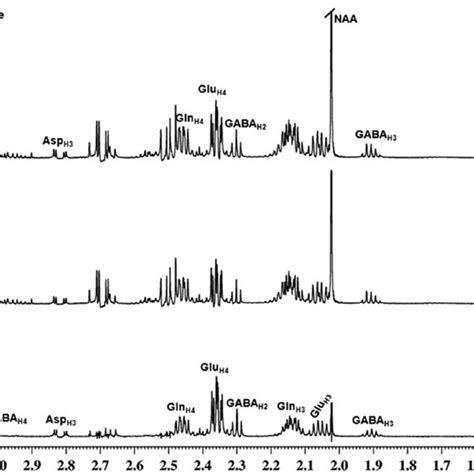 Pdf 13c Nuclear Magnetic Resonance Investigations Of Neurotransmitter Energetics In Brain