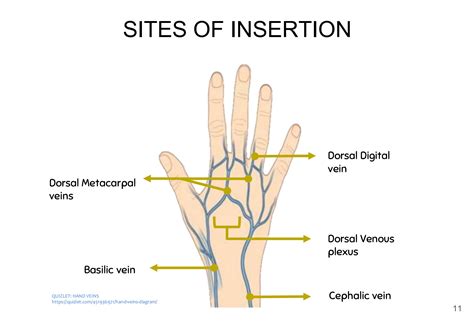 Vascular Access Devices Ceowebrn Page 11 Flip Pdf Online Pubhtml5