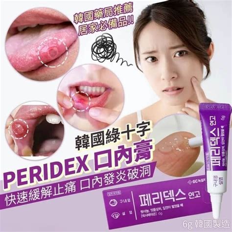 【嘴巴破第2 3天就好】gc Peridex Ointment For The Oral Cavity Disease 口腔溃疡膏 6g