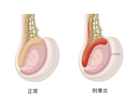 睾丸 医学插画
