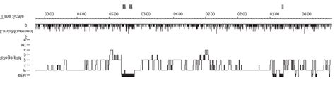 Hypnogram Showing Sleep Architecture And Limb Movement Recorded During