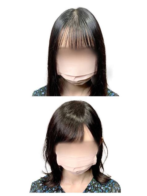地肌が透ける頭頂部は、前髪を増やして大人可愛くカバー 薄毛に悩む女性の為のヘアサロン・美容院｜telas（テラス）｜東京・大阪