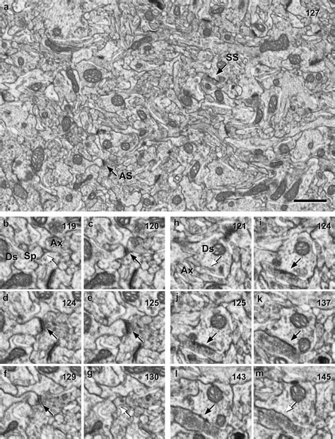 Serial Images Obtained With Combined Focused Ion Beam Milling And Download Scientific Diagram