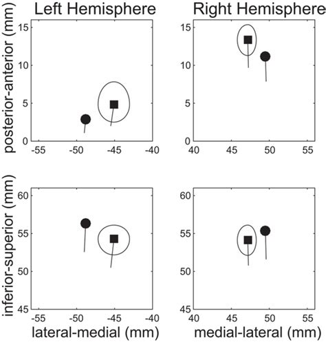 Grand Averaged Localization Of N1m Filled Circles And Sustained Field