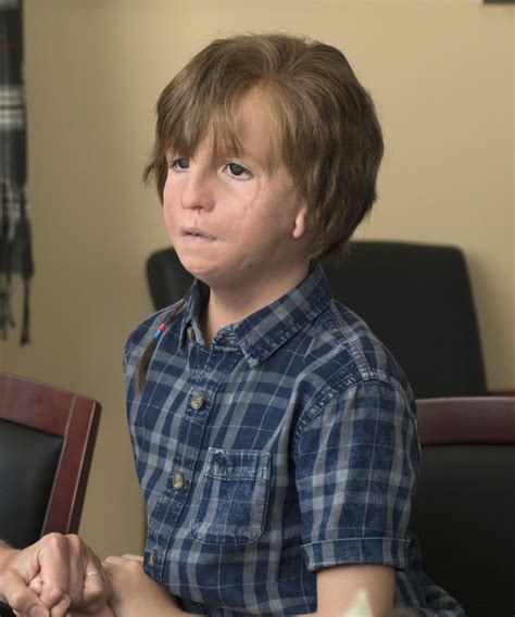 Wonder Book Facial Deformity