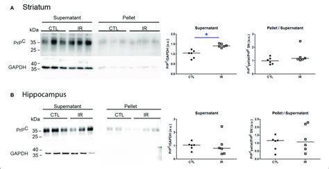 Analysis Of Prp C Solubility Soluble Supernatant And Insoluble