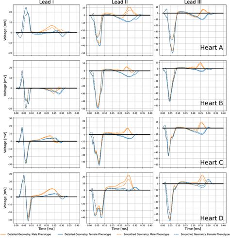 lead i ii and iii pseudo ecg results for smoothed detailed male a b