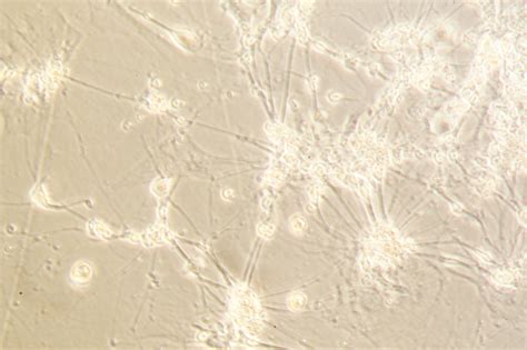 Problems With Mouse Primary Cortical Neurons ResearchGate