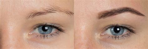 10 Ways To Fix Sparse Eyebrows Wimpole Clinic