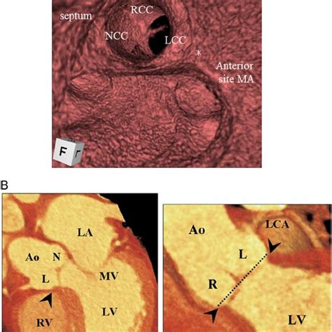 Stepwise Ecg Algorithm For The Determination Of The Location Of The Download Scientific Diagram