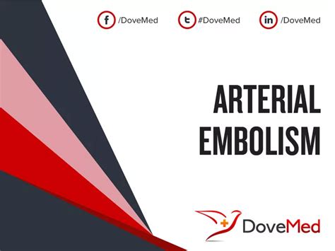 Arterial Embolism Dovemed