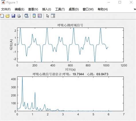 干货 Iwr1642evm呼吸心跳原始数据采集与仿真分析（含matlab代码和数据） 知乎