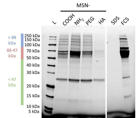 Representative Sds Page Of Sds Supernatants After Adsorption Of Serum
