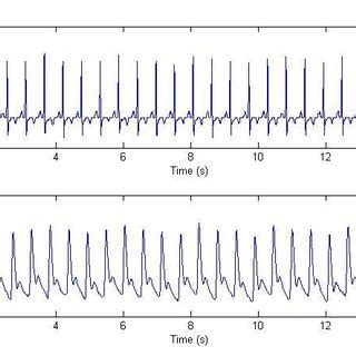Samples Of Standard ECG II And ABP Waveforms Download Scientific Diagram