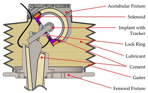 Inertial Tracking System For Monitoring Dual Mobility Hip Implants In Vitro