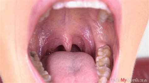 inside my mouth page 5