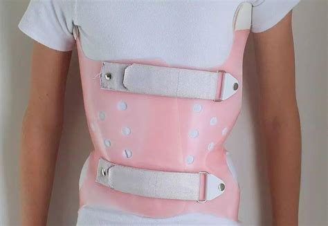 家长必读,解开你对青少年脊柱侧弯的所有疑惑 搜狐大视野 搜狐新闻 家长必读,解开你对青少年脊柱侧弯的所有疑惑 搜狐大视野 搜狐新闻