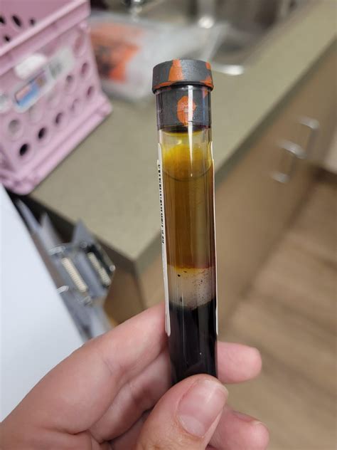 Qc Troubleshooting R Medlabprofessionals