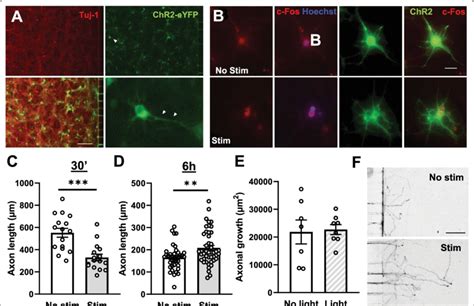 Optogenetic Stimulation Of Cortical Neurons After Axotomy A Cortical