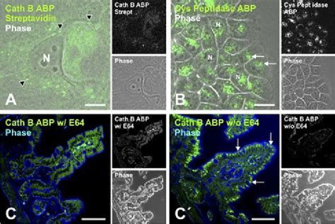 Employment Of Activity Based Probes For Spotting Enzymatic Activity