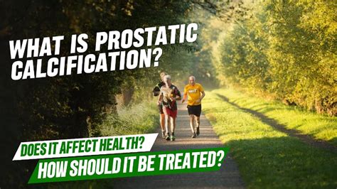 What Is Prostatic Calcification Does It Affect Health How Should It