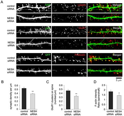 Dendritic Spine Synapse