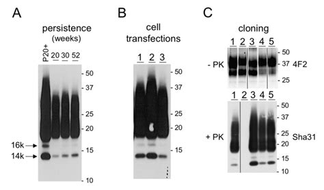 Persistence Of The Pk Resistant Form In Cultures Insolubility Of Prp