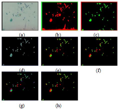 Example Of Hnn And Fcm Segmentation Algorithm For Blue Dye Image A Download Scientific