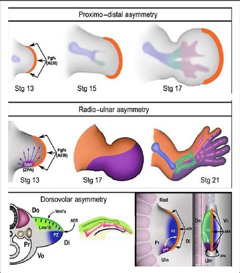 Figure 2 From Classification Of Congenital Anomalies Of The Hand And