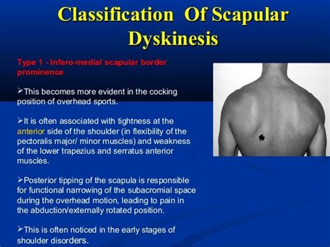 Rotatory Cuff Syndrome And Scapular Dyskinesia