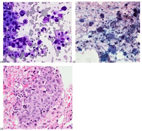 Thyroid Tales First Edition Lablogatory