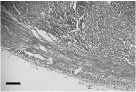 Light Micrograph Of Adhesion Area Showing Nonspecific Inflammatory Cell Download Scientific