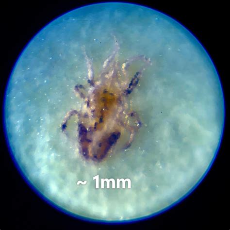 Help Us Identifying This Tiny Bug R Bugidentification