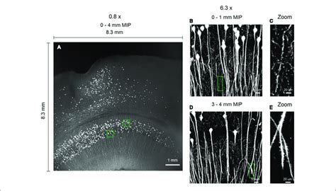3d Imaging Of Expanded Brain Slices At Submicron Resolution A 3d Download Scientific